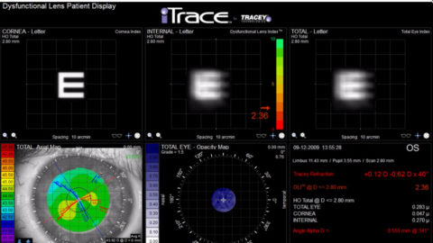 Ongoing Advancement of The iTrace Visual Analysis | Tracey Technologies