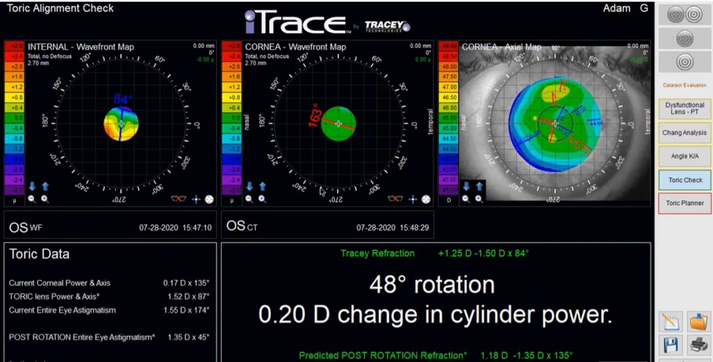 How iTrace Ophthalmic Technologies Works?