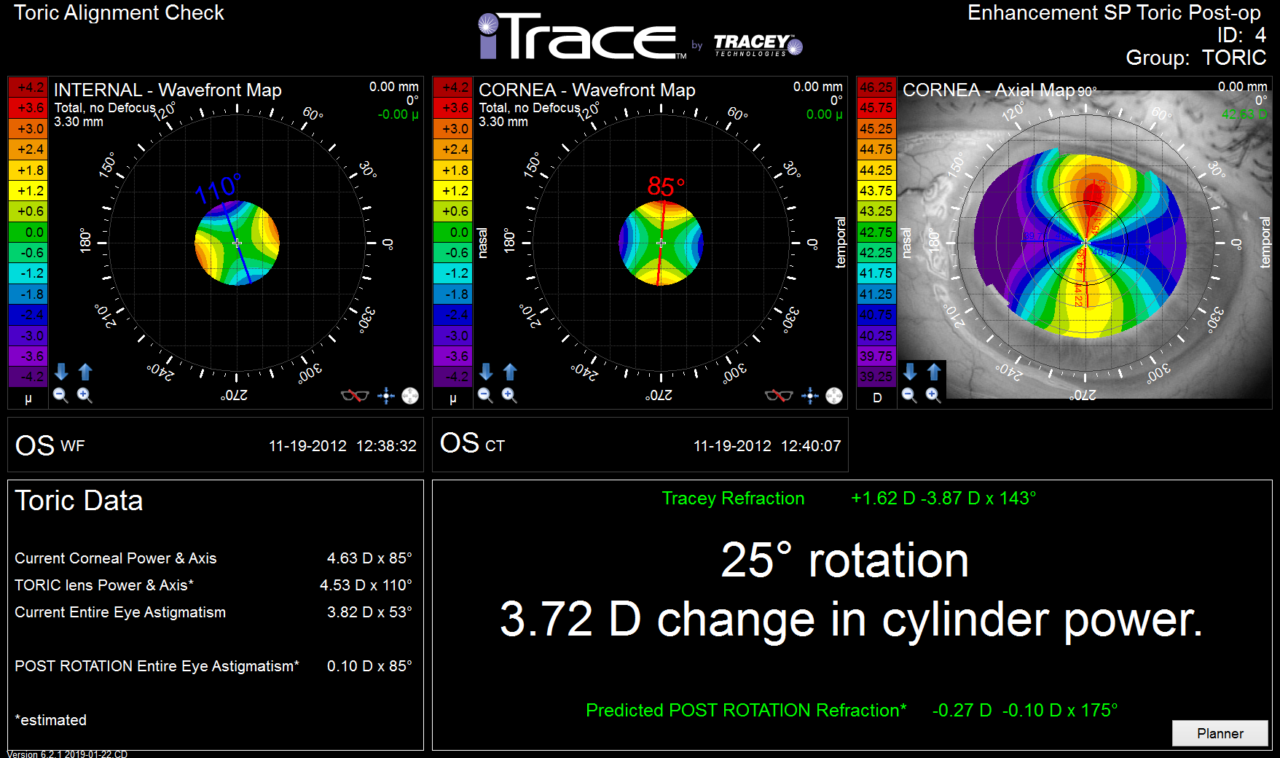 The iTrace vs. The NIDEK/Marco OPD III | Tracey Technologies