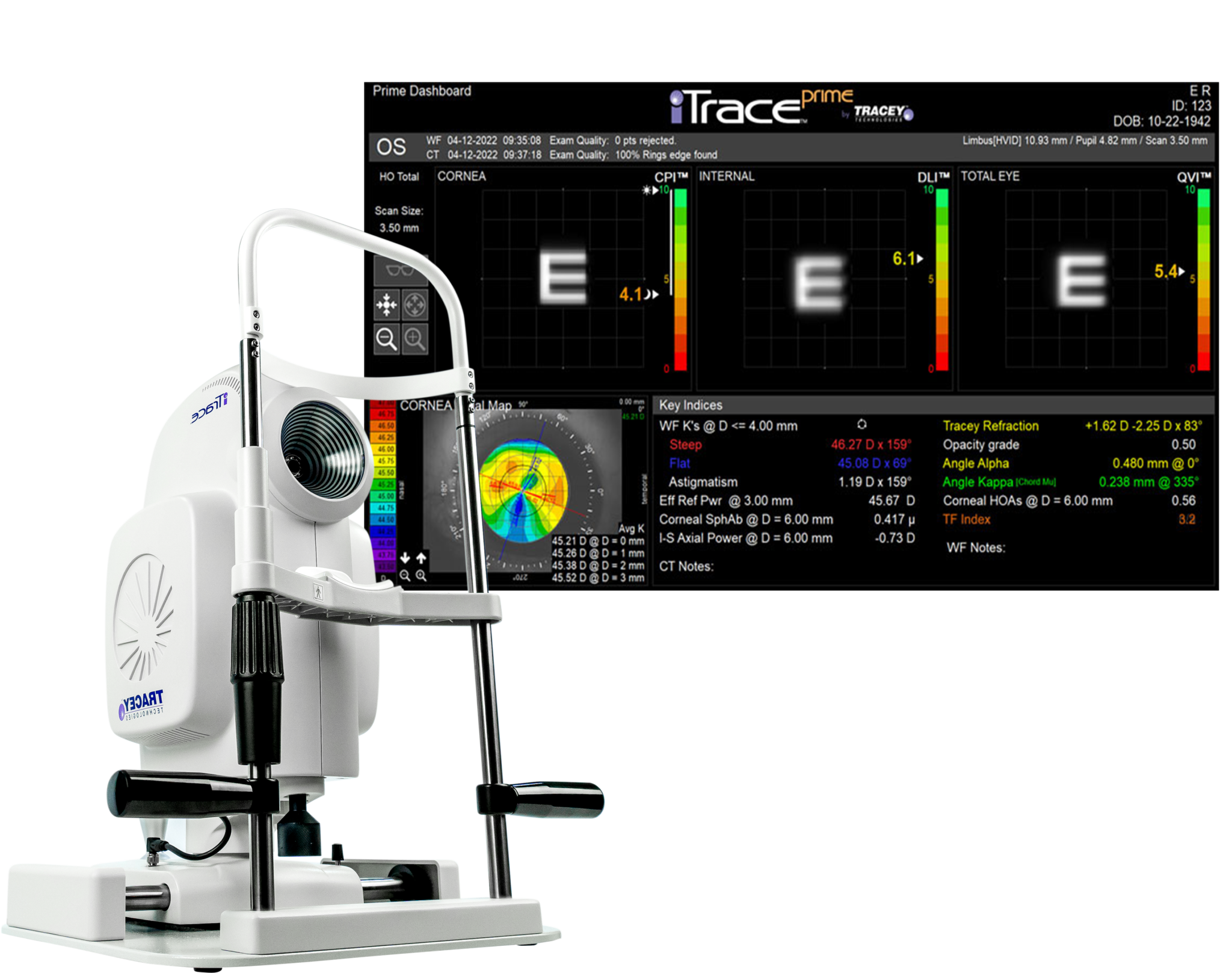Advanced iTrace Technology | Eye Scanner | Tracey Technologies