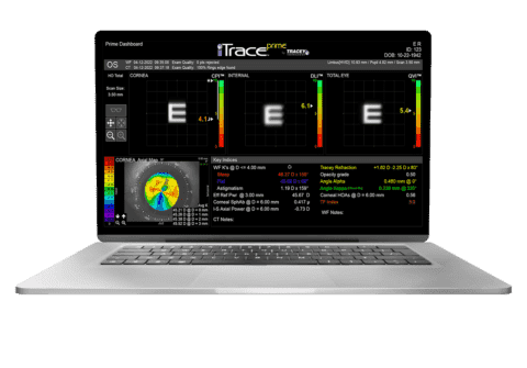 Advanced iTrace Technology | Eye Scanner | Tracey Technologies