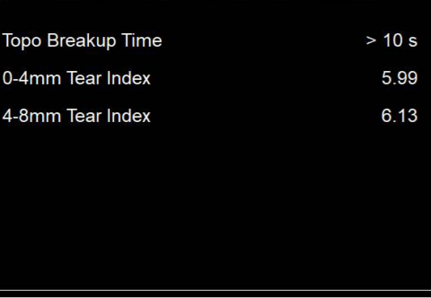 Tear Film Analysis | Tracey Technologies